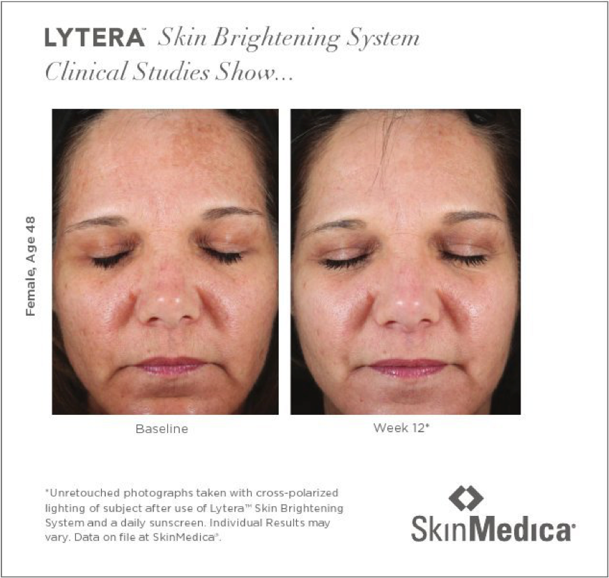 SkinMedica - Sérum éclaircissant Lytera 2.0 - 60ml